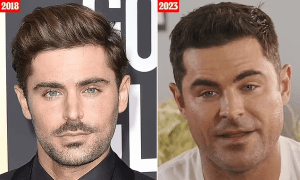What Happened To Zac Efron'S Face? The Shocking Transformation Revealed - Rising Net Worth